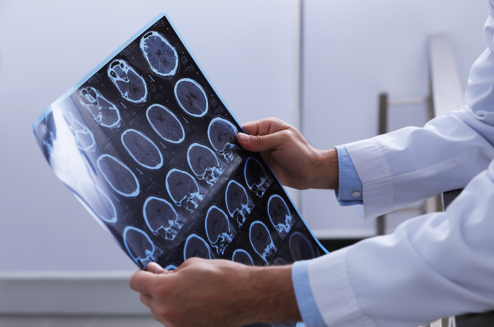 Georgia Nursing Home Abuse Lawyer | Rob Schenk